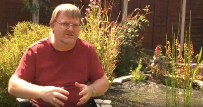 Surgery Mistakes & Complication Claims Solicitors | Irwin Mitchell